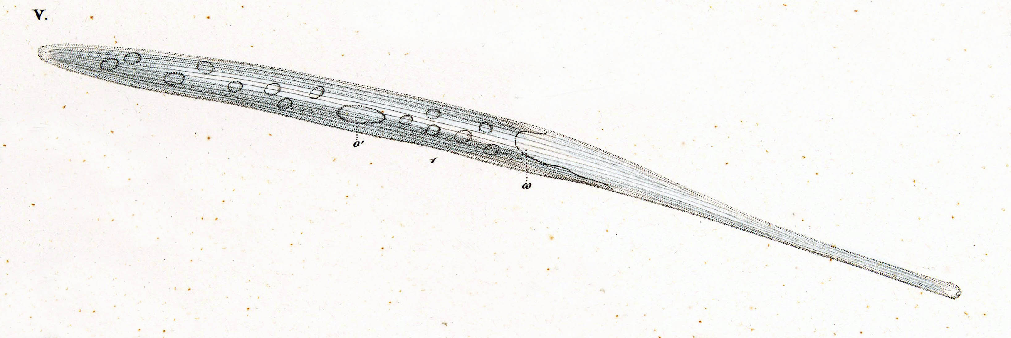 Spirostomum Labeled